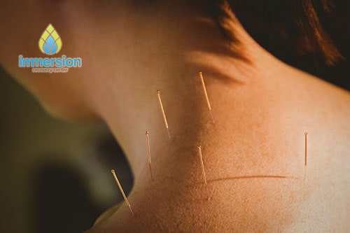 Acupuncture Therapy for Substance Abuse & Addiction Treatment